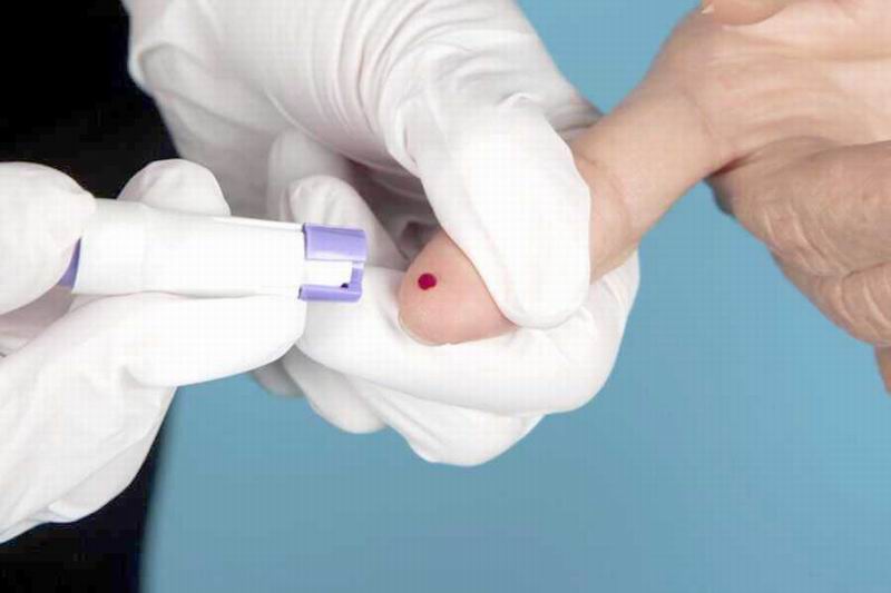 Remarcan la importancia de hacerse el test o prueba del VIH-SIDA ...
